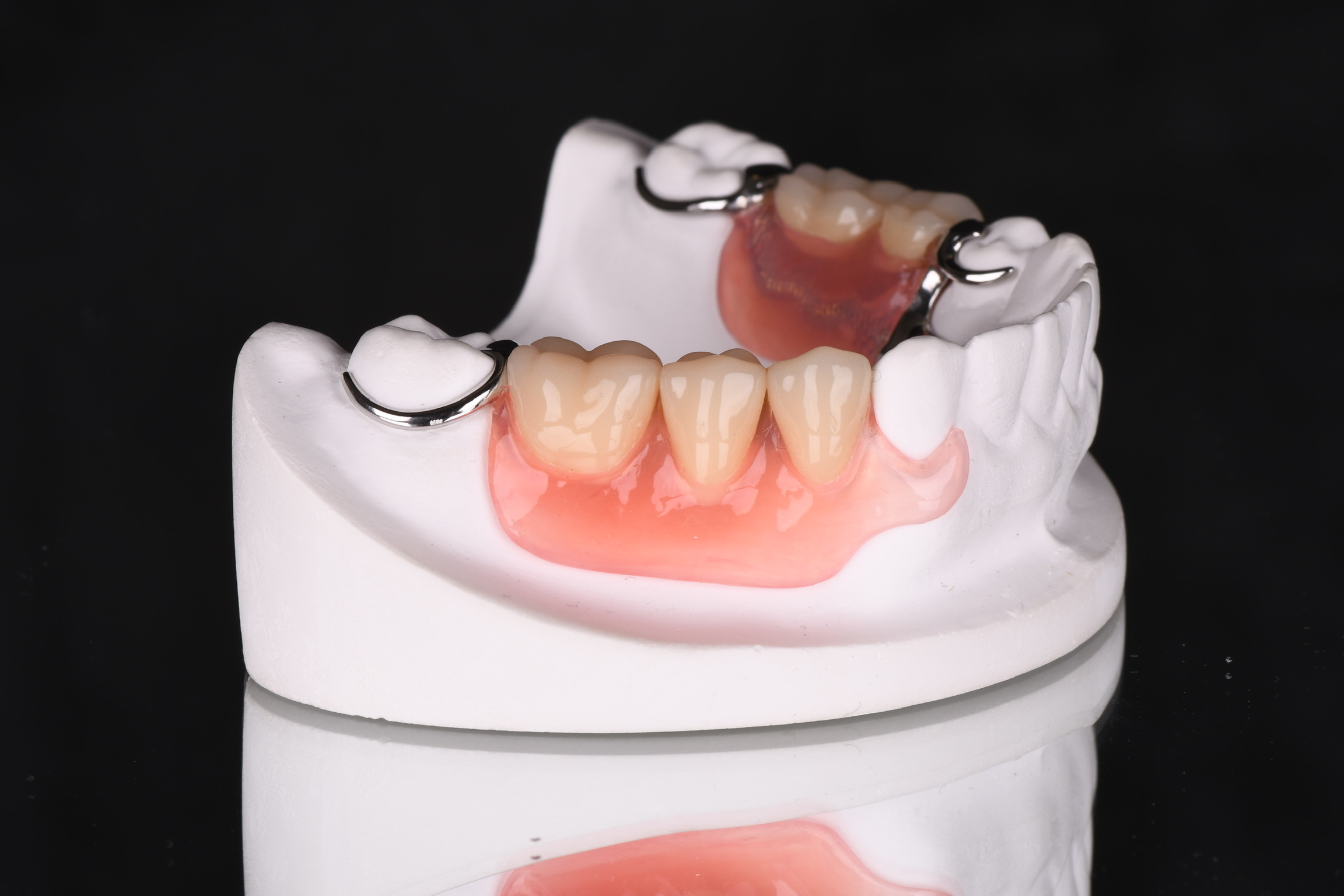 Dental Partials Guide: Materials, Fit & Lab Selection